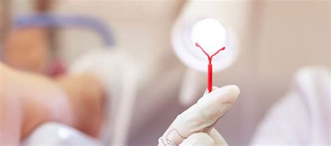 Info Biaya Lepas IUD (KB Spiral) di Puskesmas, Klinik, & Rumah Sakit – Daftar Harga & Tarif 2023