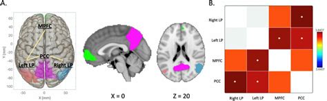 Functional Connectivity Within The Default Mode Network During Mid Task
