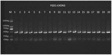 Primer And Method For Detecting Fgd1 Gene Mutation Eureka Patsnap