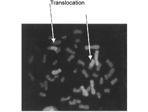 Chromosome Aberration By Detected Fluorescence In Situ Hybridization