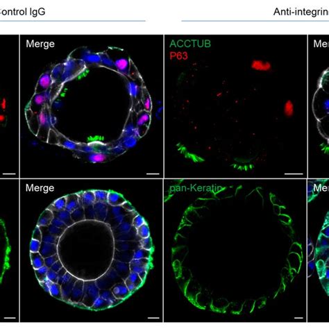 Integrin β1 Mediates Epithelial Polarity Of The Airway Organoids Download Scientific Diagram
