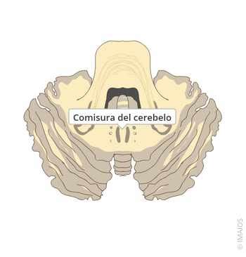 Comisura Del Cerebelo E Anatomy Imaios