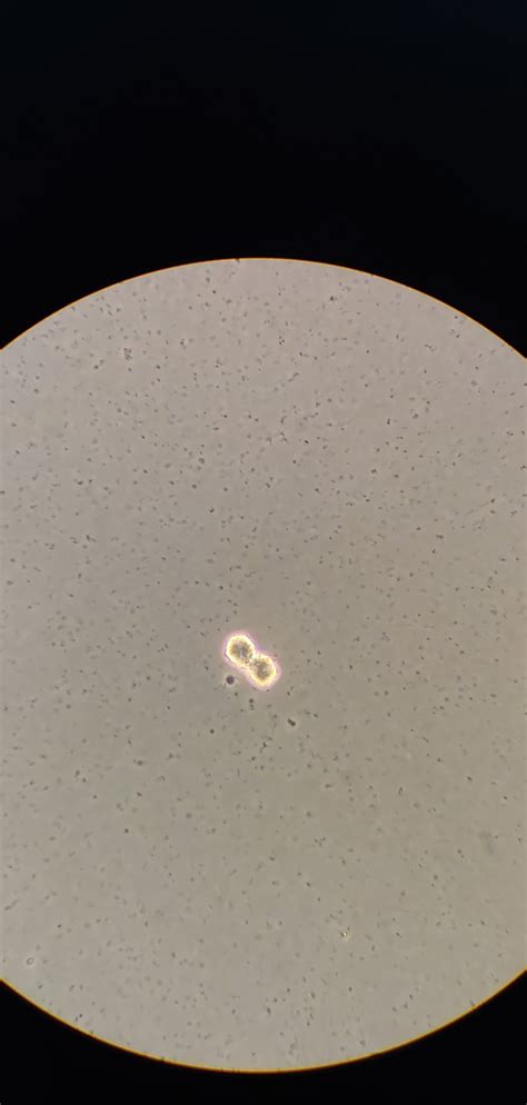 104 Questions With Answers In Thp 1 Cells Science Topic