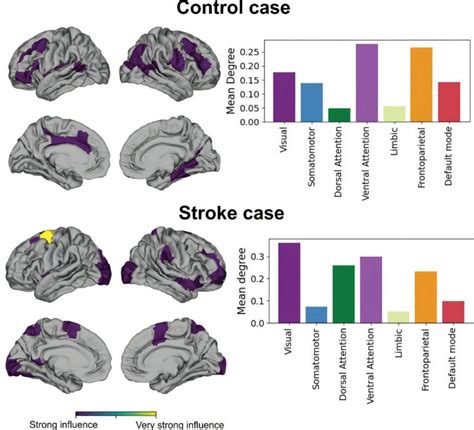 Advancing Stroke Imaging Analysis With Interpretable Ai And Effective Connectivity Models