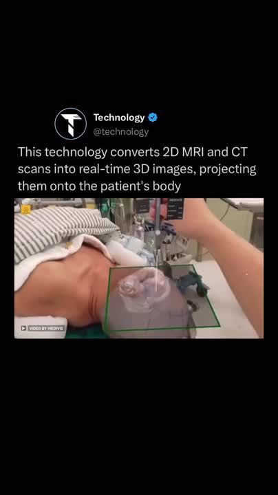 Kiran Kumar Ss On Linkedin Health Hospital Technology Reels Doctor