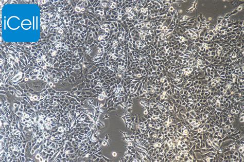 Gl261 Luc 小鼠胶质细胞瘤 Luc 原代细胞 Str细胞 细胞培养基 镜像绮点生物