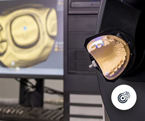 Bitewing X Ray Definition Uses And Key Differences Craniocatch