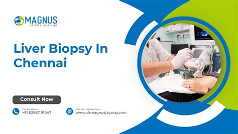 100 Best Liver Biopsy In Chennai Advanced Treatment