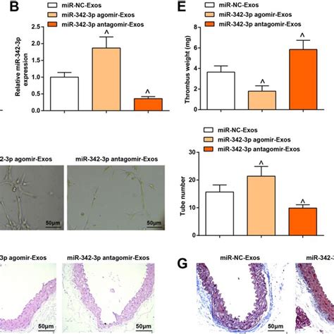 Hucmscs Exos Induce The Repair Of Venous Thrombosis In Rats With Dvt A Download Scientific