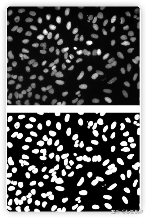 3d分割项目 基于pytorch3dunet实现的3d体积语义分割算法 知乎