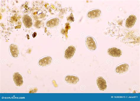 Eggs Of Hookworm In Human Stool Stock Image Image Of Human Organism 163838615