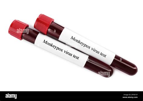 Monkeypox Virus Test Sample Tubes With Blood On White Background Stock