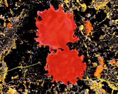 Echinocytes Art For Sale Pixels