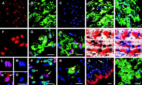 Expanding Expression Of The 5 Lipoxygenase Pathway Within The Arterial Wall During Human