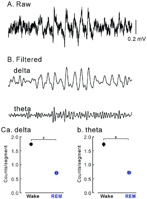 Transient Slower Oscillatory Theta And Delta Events A And B Typical Download Scientific