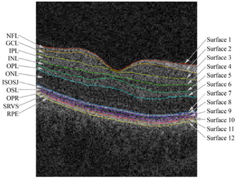 Oct Retinal Layers Segmentation