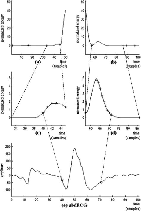 Maternal Fiducial Point Detection A E T For The Sub Window [t I −