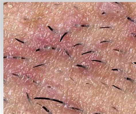 Female Genitalia Flashcards Quizlet