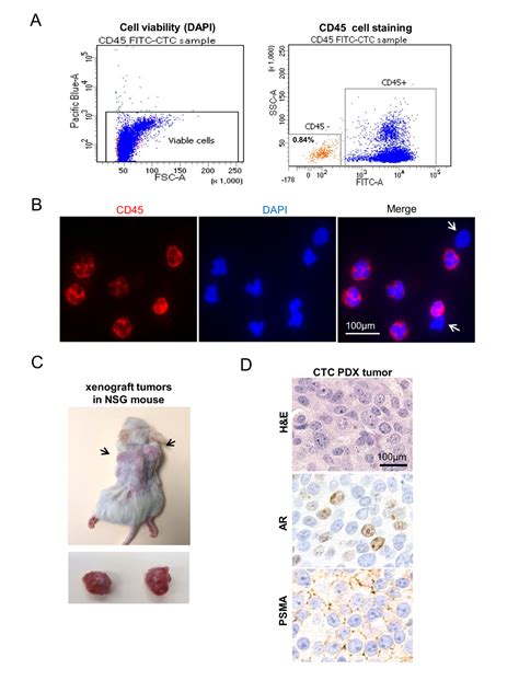 Generation Of Prostate Cancer Patient Derived Xenograft Models From