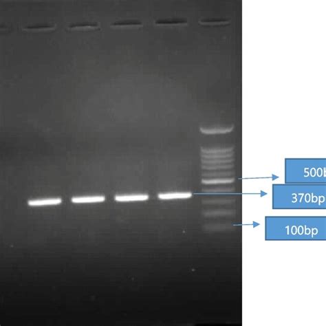 Polymerase Chain Reaction Pcr Assay For Listeria Monocytogenes Download Scientific Diagram