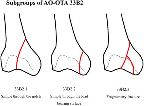 Subgroup Of Ao Ota Classification 33b2 Download Scientific Diagram
