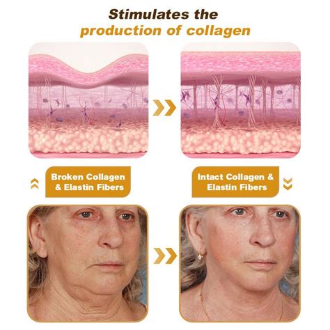 🧡reclaim Youthful Skin Now 👩‍⚕️ Botox Bee Venom Wrinkle Removal