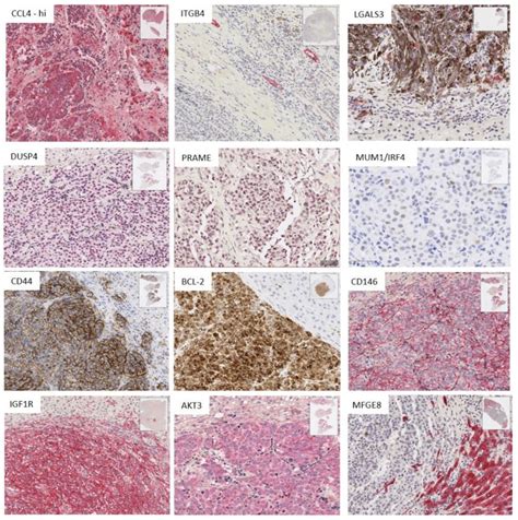 Immunohistochemistry Ihc Results Showing The Staining Pattern And