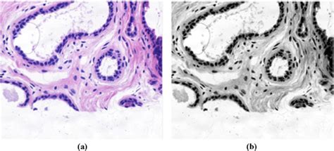 Image Enhancement Using Contrast Limited Adaptive Histogram