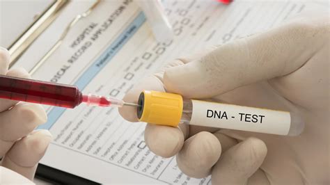 El Simple Test De Adn Que Puede Detectar 18 Tipos De Cánceres En Etapa Temprana Infobae