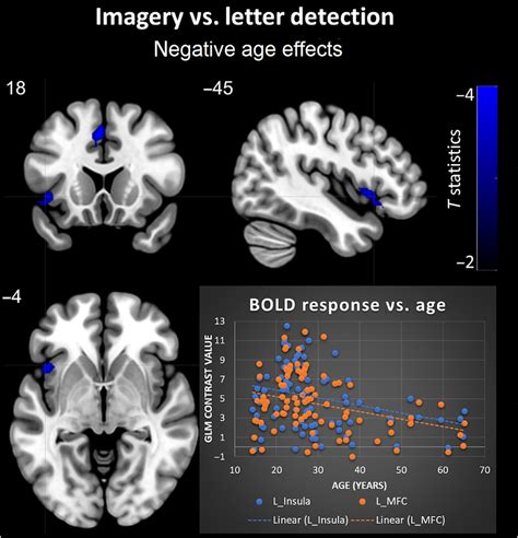Age Influence On Main Effect Task Brain Clusters With Fmri Response To Download Scientific