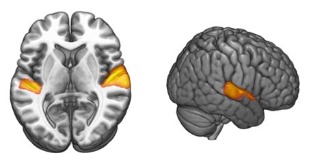 Video Measuring Grey Matter Differences With Voxel Based Morphometry The Musical Brain