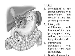 Gastrectomypptx