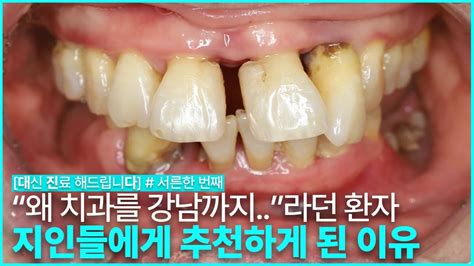 대진다 너무 불편하신 나머지 전라남도 광주에서 서울까지 내원해 주신 환자분│당일 임플란트 임플란트 뼈이식 임시치아