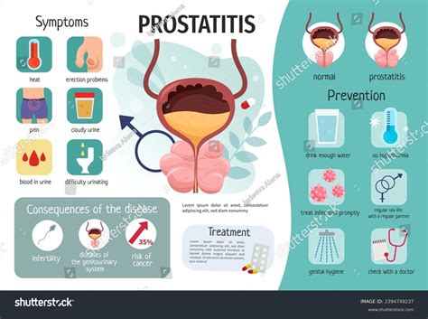 Vector Medical Poster Prostatitis Infographics Diseases Stock Vector
