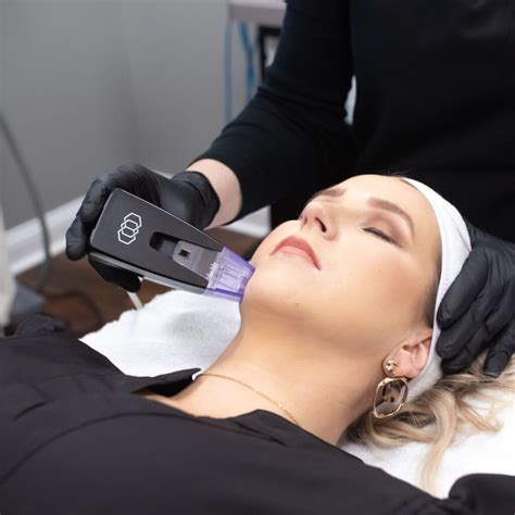 Microneedling With Radiofrequency RF Blue Spiral Medical Spa