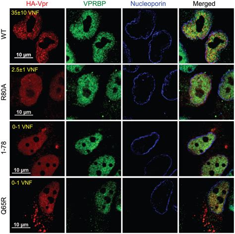 Analysis Of The Capacity Of Vpr Mutants To Form Nuclear Foci Hela