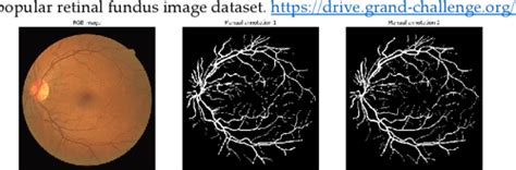Pdf U Net And Its Variants For Medical Image Segmentation A Review