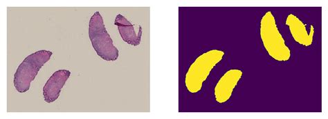 semantic segmentation models tia toolbox 1 4 0 documentation