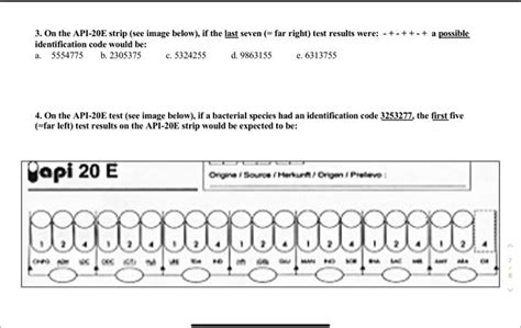 On The Api 20e Strip If The Last Seven Far Right Test Results Were A Possible