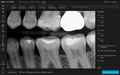 Align X Ray Insights Home