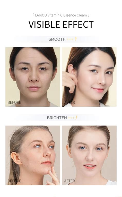 비타민 C 화이트닝 주근깨 페이스 세럼 크림 다크 스팟 제거 멜라닌 리페어 히알루론산 모이스처 라이저 브라이트닝 스킨 케어 Aliexpress