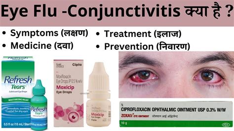 Eye Flu Conjunctivitis Types Treatment Ilaj Medicine Eye Drop Kya Hai Youtube
