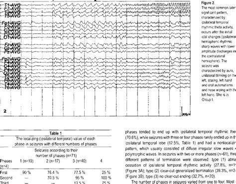 Figure 2 From Ictal Scalp Eeg Findings In Patients With Mesial Temporal