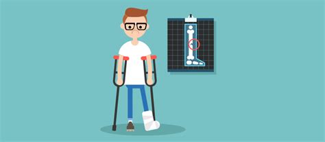 Comminuted Vs Compound Fractures Whats The Difference