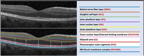 Graph Showing The Automatic Delineation Of The Nine Retinal Layers And Download Scientific