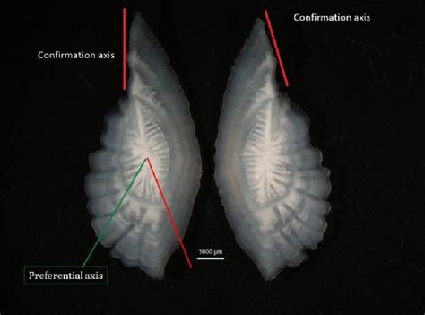 Recommended Areas For Otolith Reading Download Scientific Diagram