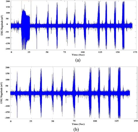 A Semg With Electrical High Frequency Interference “red Line Represents