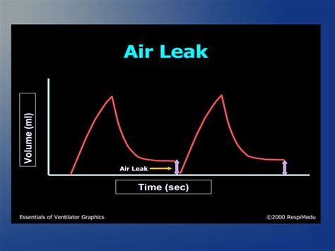 Ventilator Waveforms Dr Sanjay Chugh Pptx Lung And Respiratory Health