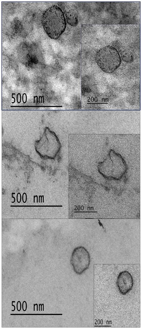 Three Examples Of Different Microparticles Found In Mucin In All Cases Download Scientific