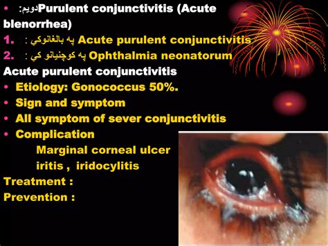Conjunctival Diseases By Dr Abdul Basir Safi Ppt Ear Nose And